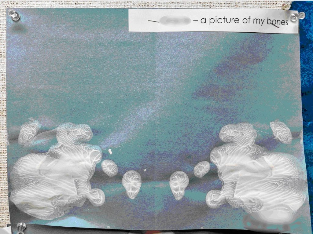 Children, Pain, and Rorschach Images Lynn R. Webster, M.D.