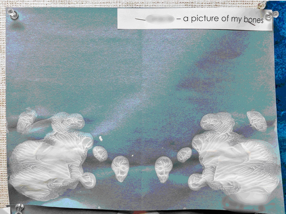 Children, Pain, and Rorschach Images Lynn R. Webster, M.D.